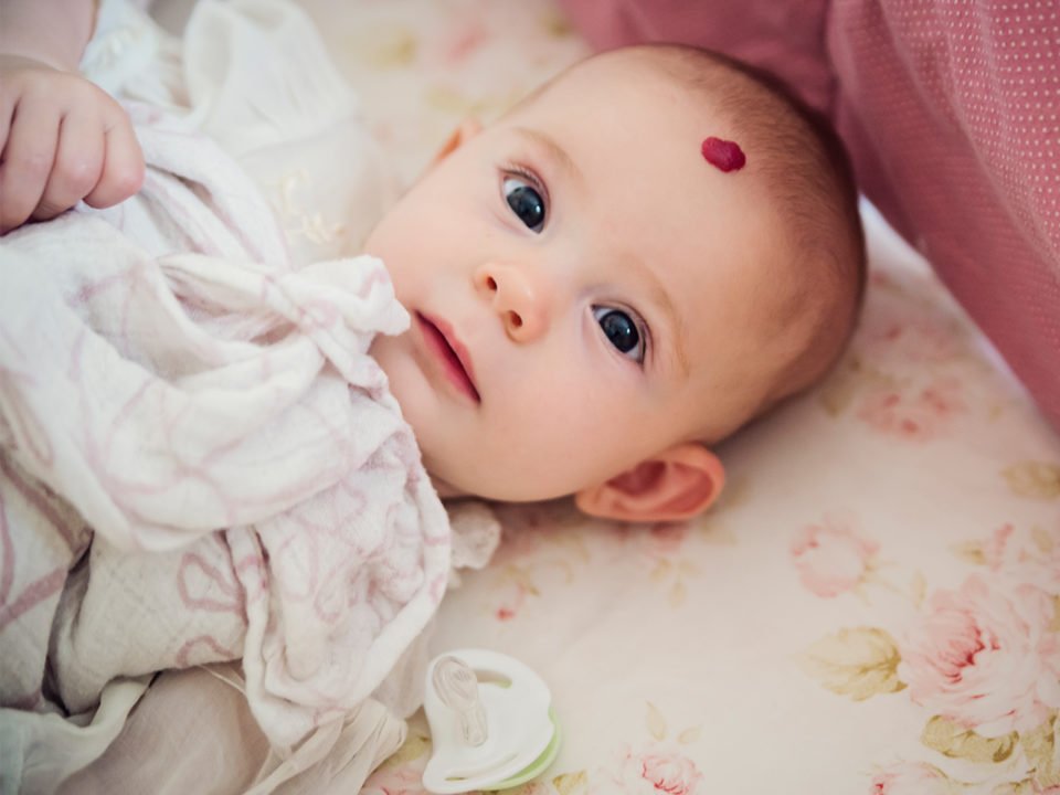 What Do Birthmarks Mean?